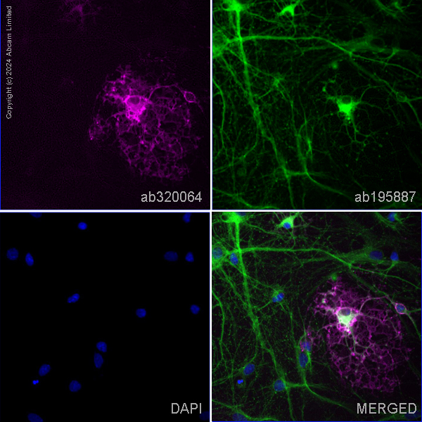 Alexa Fluor® 594 Anti-CNPase antibody [11-5B] (ab320064) | Abcam