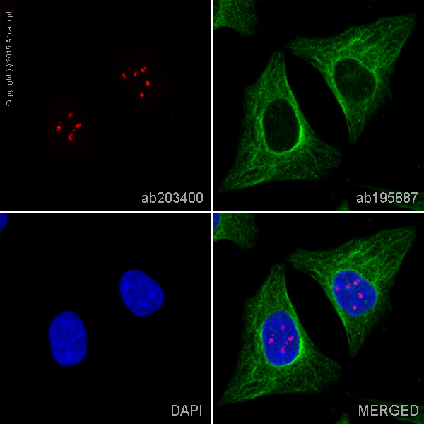 Fibrillarin抗体- Nucleolar Marker (ab5821)| Abcam中文官网