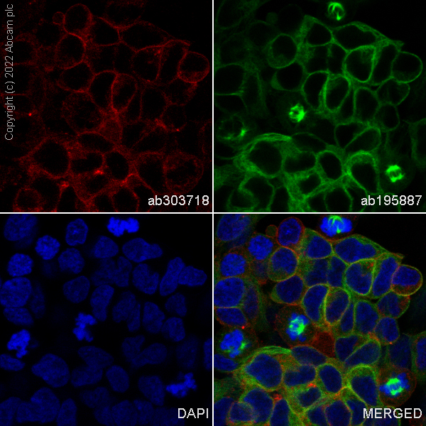 Alexa Fluor® 594 Anti-NCAM1 antibody [EP2567Y] (ab303718) | Abcam