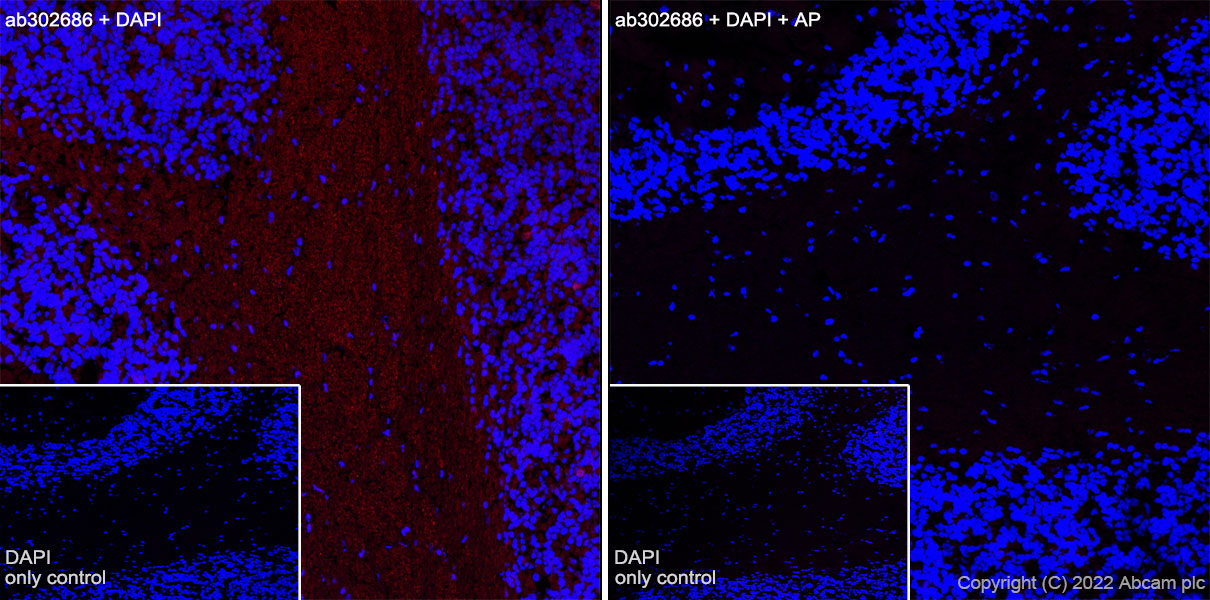 Anti-Tau (phospho S396) Alexa Fluor® 594 antibody [EPR2731] (ab302686) | Abcam