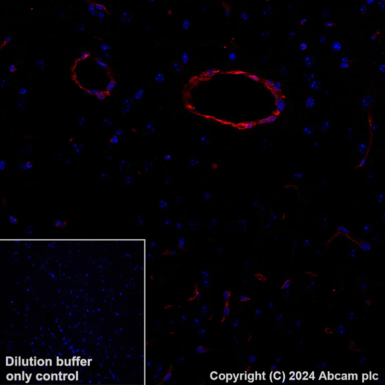 Anti-Annexin V/ANXA5 Alexa Fluor® 647 antibody [EPR28047-61] (ab318176) | Abcam