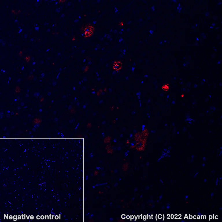 Alexa Fluor® 647 Anti-beta Amyloid 1-42抗体[mOC64] (ab300742)| Abcam中文官网
