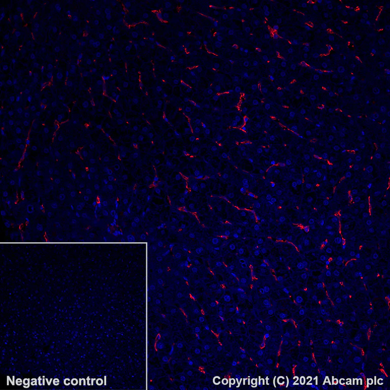 Anti-CD16 - C-terminal Alexa Fluor® 647 antibody [EPR16784] (ab283695 ...