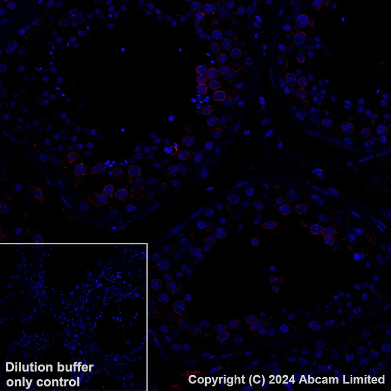 Alexa Fluor® 647 Anti-CD168 antibody [EPR4054] (ab319128) | Abcam