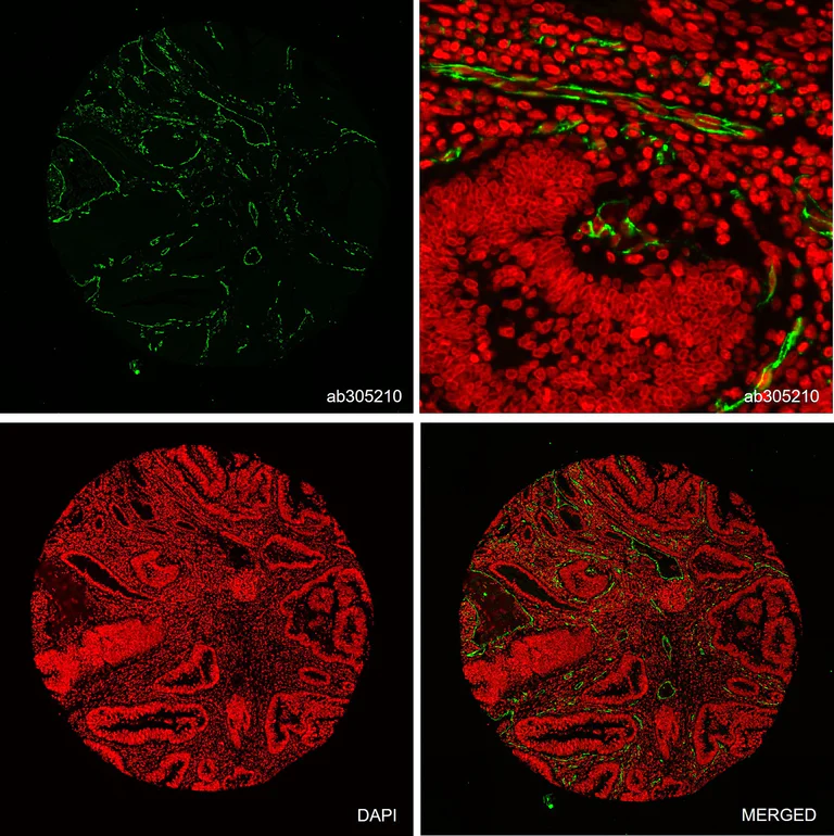Alexa Fluor® 647 conjugated Anti-CD31 antibody [EPR17259] (ab305210) | Abcam