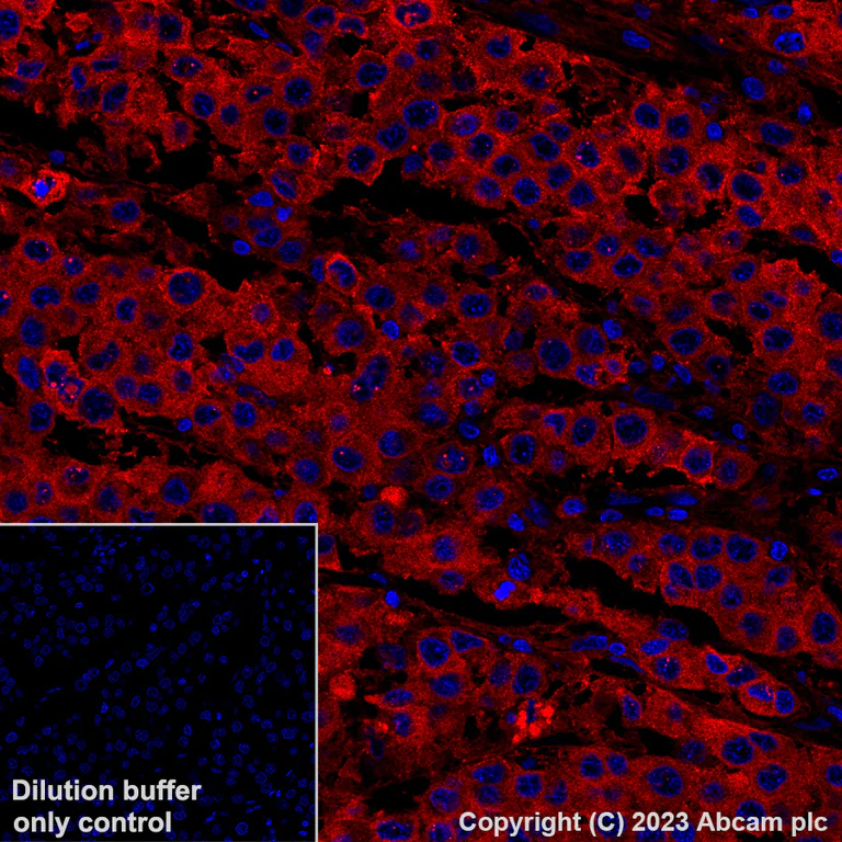 Alexa Fluor® 647 Anti-CD63 - Late Endosome Marker antibody [EPR5702 ...