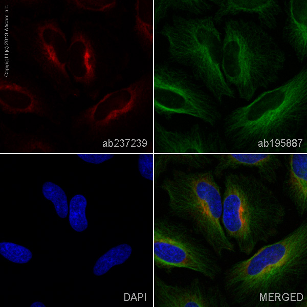 Anti-Collagen III Alexa Fluor® 647 antibody [EPR17673] (ab237239) | Abcam