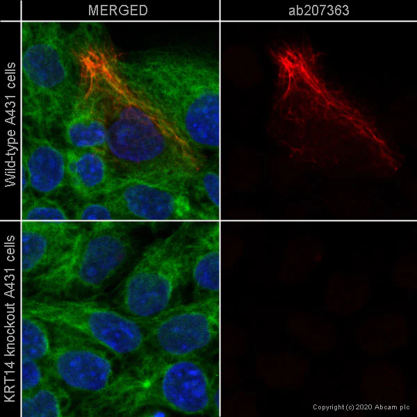Alexa Fluor® 647 Anti-Cytokeratin 14 antibody [EPR1612] (ab207363) | Abcam