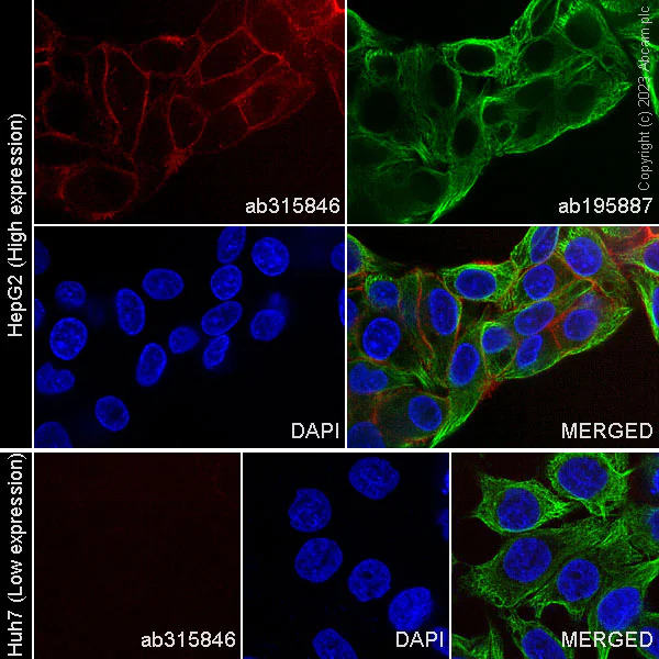 Alexa Fluor® 647 Anti-ENPP1/PC1 antibody [EPR22262-22] (ab315846) | Abcam