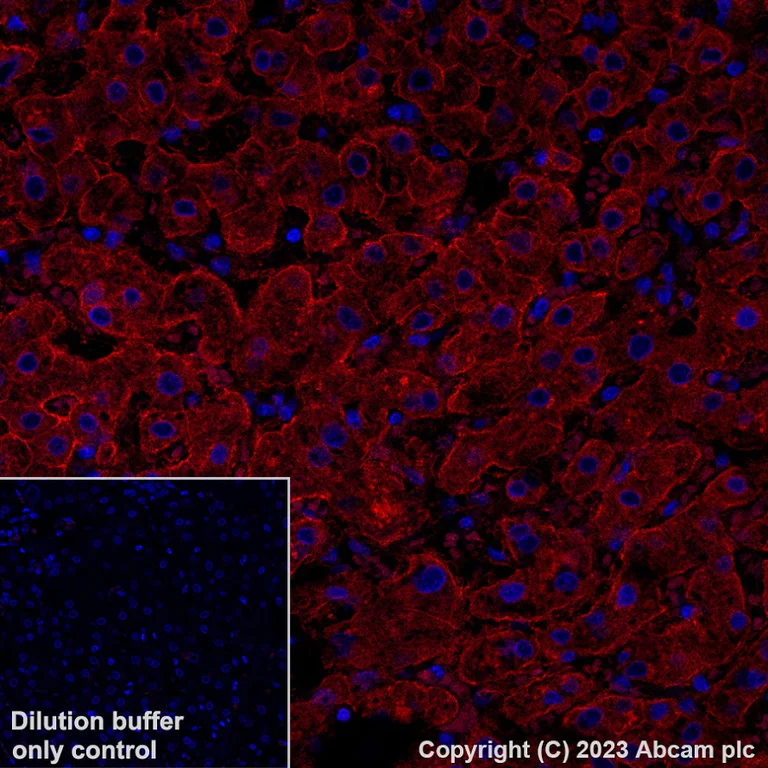 Alexa Fluor® 647 Anti-ENPP1/PC1 antibody [EPR22262-22] (ab315846) | Abcam
