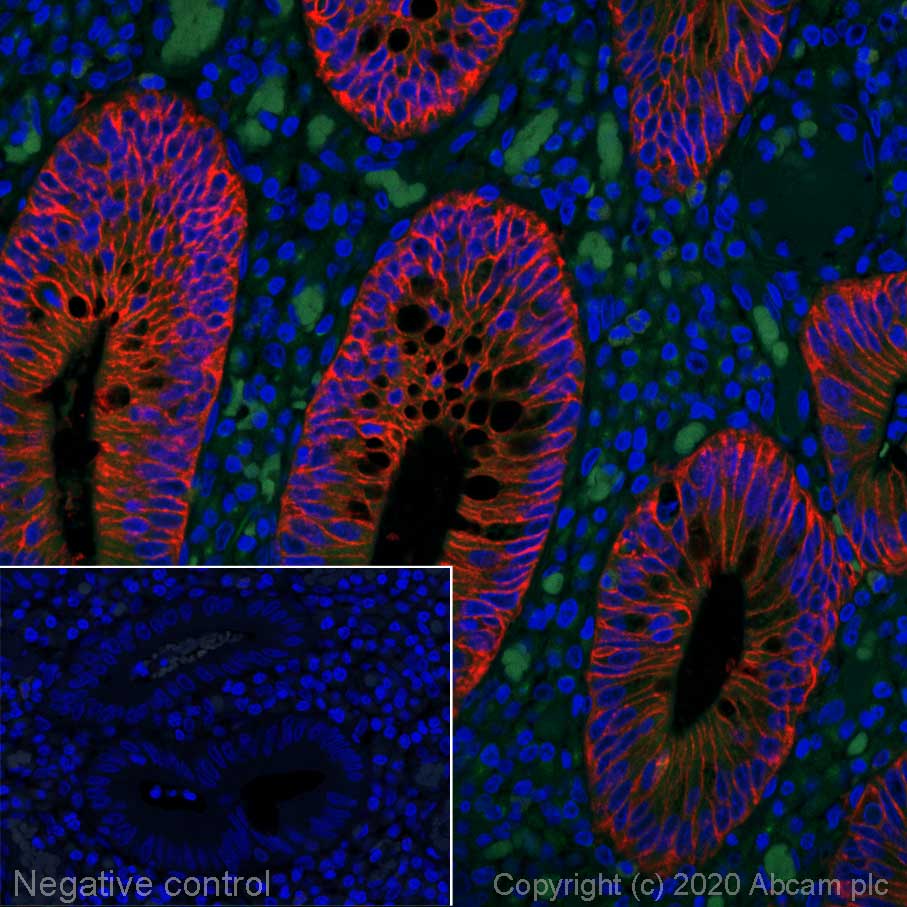 Anti-EpCAM Alexa Fluor® 647 antibody [EPR677(2)] (ab275346) IgG | Abcam