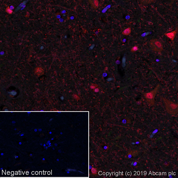 Alexa Fluor® 647 Anti-GDF11 + GDF8/Myostatin antibody [EPR4567(2 ...