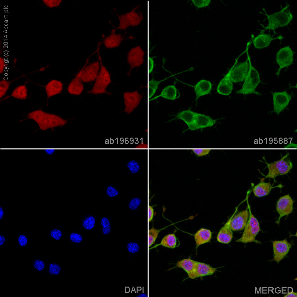 Alexa Fluor® 647 Anti-Huntingtin antibody [EPR5526] (ab196931) | Abcam