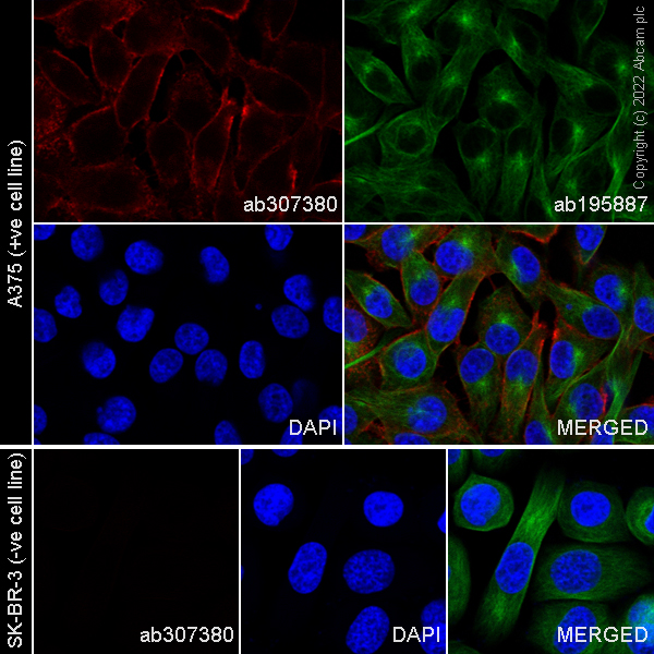 Alexa Fluor® 647 Anti-NG2 antibody [EPR22410-145] (ab307380) | Abcam