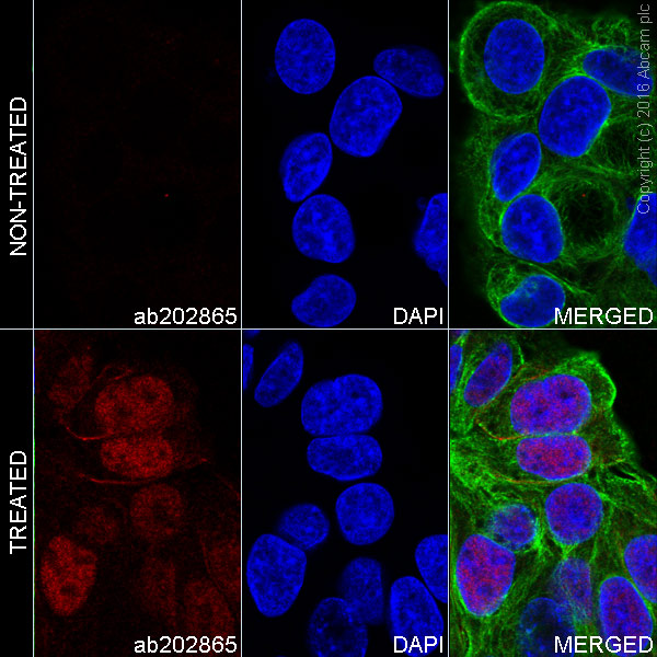 Alexa Fluor® 647 Anti-p53 (phospho S46) antibody [EP42Y] (ab202865) | Abcam