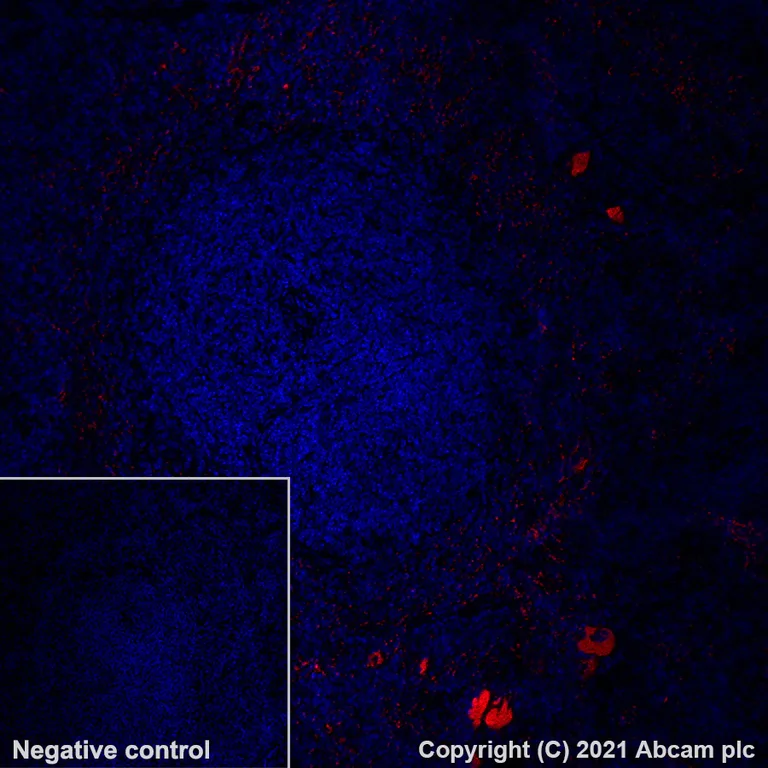 Anti-PF4 Alexa Fluor® 647 antibody [EPR7763] (ab280969) IgG | Abcam