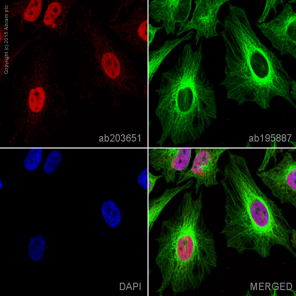 Alexa Fluor® 647 Anti-PFKFB3 antibody [EPR12594] (ab203651) | Abcam