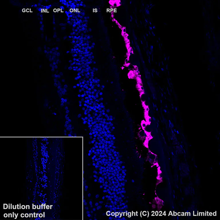 Alexa Fluor® 647 Anti-RPE65 antibody [EPR22579-44] (ab322022) | Abcam