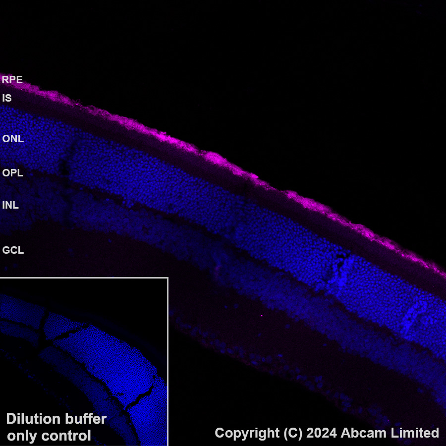 Alexa Fluor® 647 Anti-RPE65 antibody [EPR22579-44] (ab322022) | Abcam