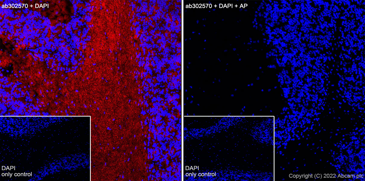 Anti-Tau (phospho S396) Alexa Fluor® 647 antibody [EPR2731] (ab300748) | Abcam