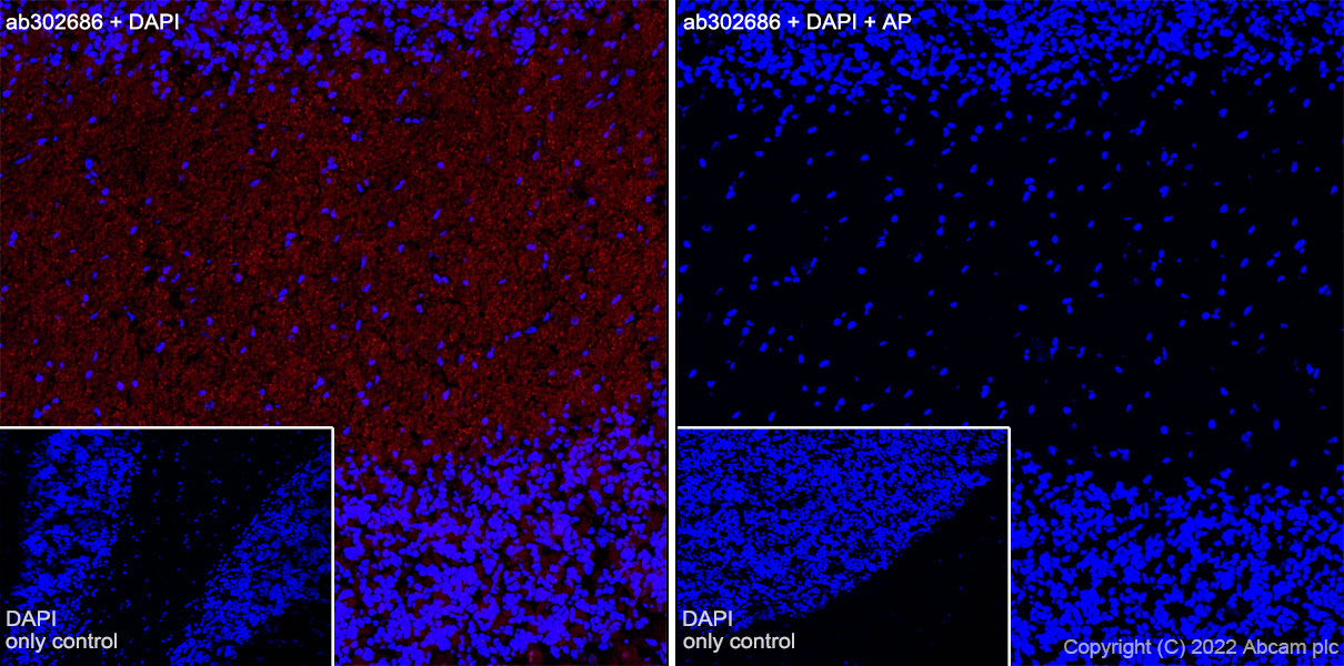 Anti-Tau (phospho S396) Alexa Fluor® 647 antibody [EPR2731] (ab300748) | Abcam