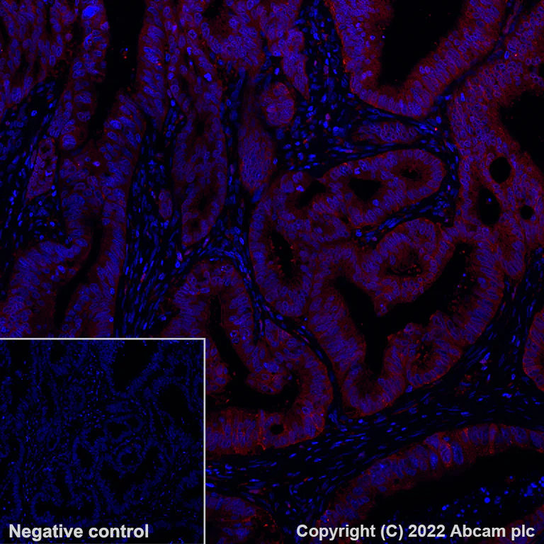 Alexa Fluor® 647 Anti-TMS1/ASC 抗体 [EPR23978-28] (ab300732) | Abcam