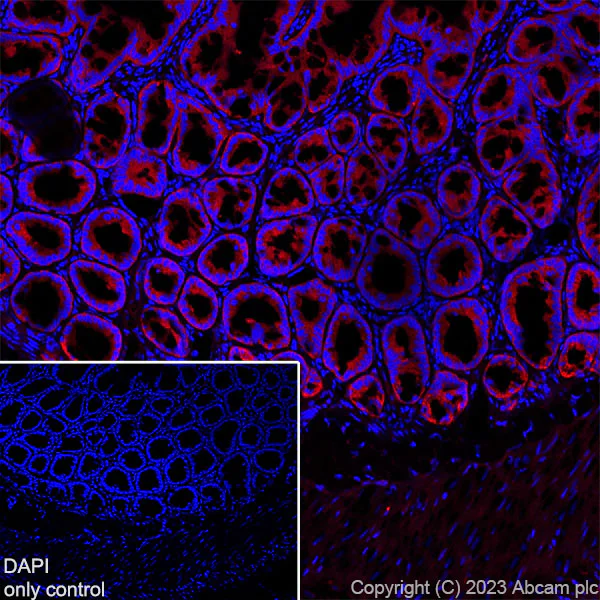 Alexa Fluor® 647 Anti-TOMM20 antibody [EPR15581-39] - Rat IgG2a ...
