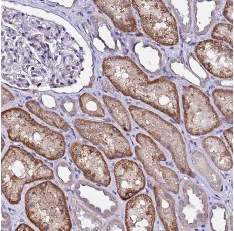 Anti-ALG3 antibody (ab151211) | Abcam