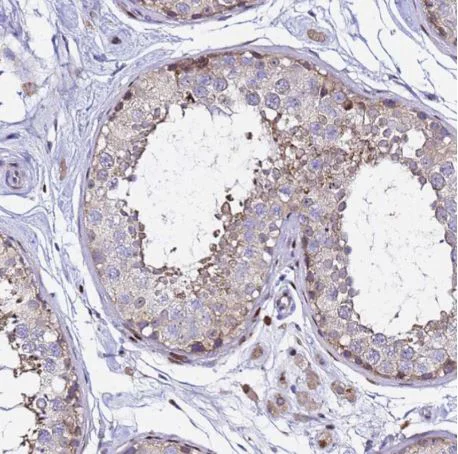 ALG3抗体 (ab151211)| Abcam中文官网