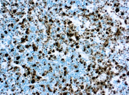 Anti-ALK antibody [4A4] (ab254288) | Abcam