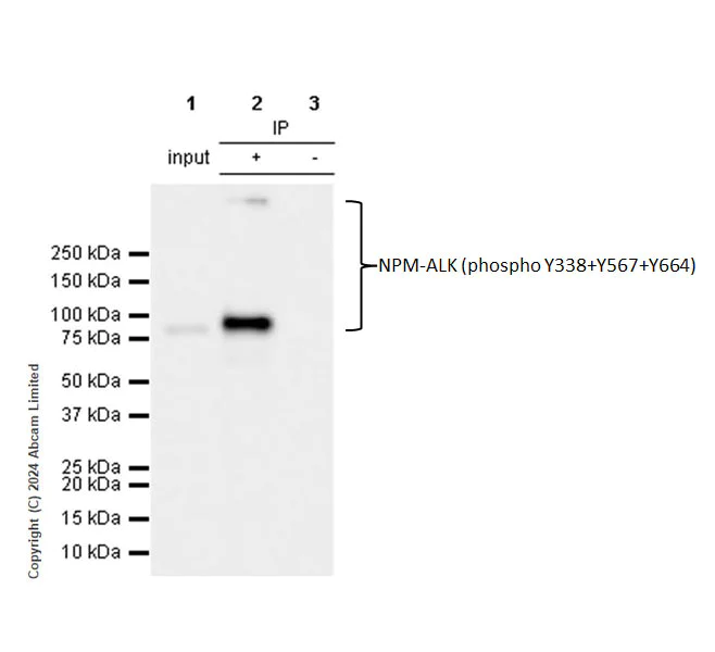 Anti-ALK (phospho Y1278 + Y1507 + Y1604) antibody [RM1164] (ab322000 ...