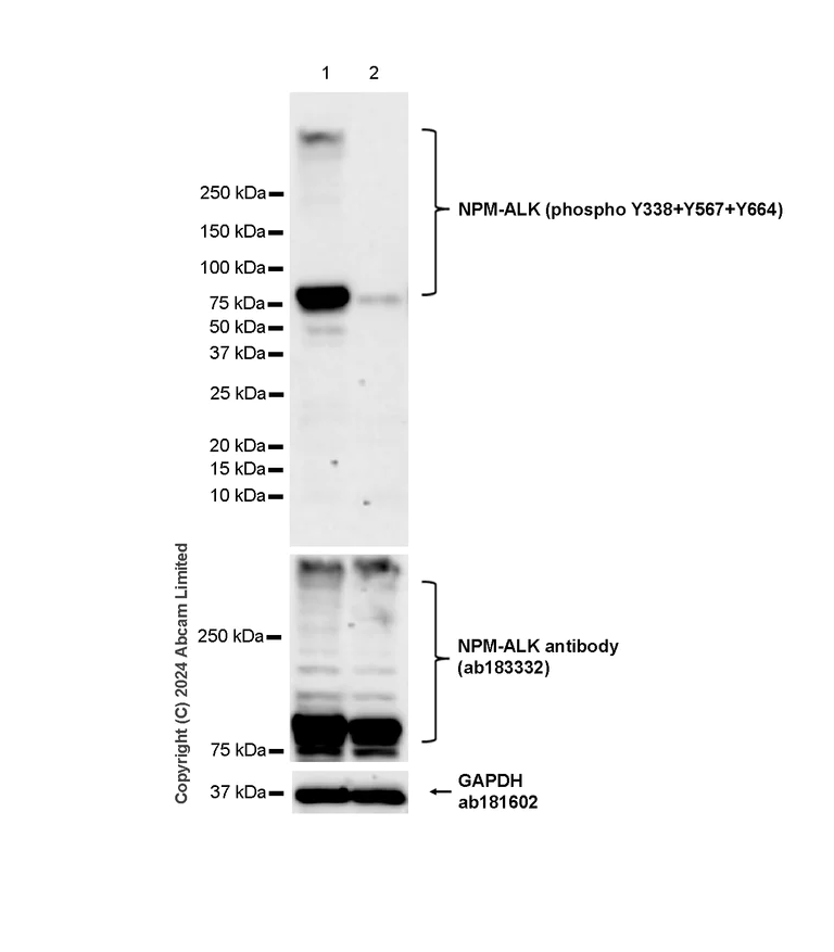 Anti-ALK (phospho Y1278 + Y1507 + Y1604) antibody [RM1164] (ab322000 ...