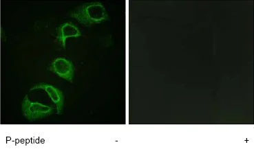 Anti-ALK (phospho Y1604) antibody (ab62185) | Abcam