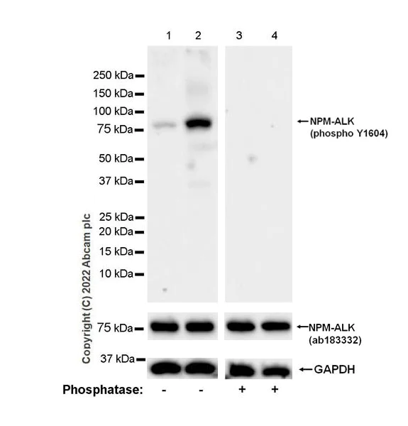 Anti-ALK (phospho Y1604) antibody [EPR24750-116] (ab290733) | Abcam