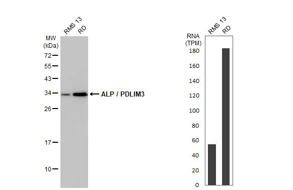 Anti-ALP / PDLIM3 antibody [HL2075] (ab317130) | Abcam中文官网