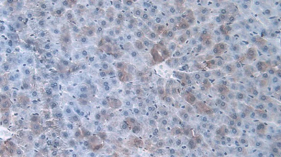Alpha 1 Acid Glycoprotein/AGP抗体[C1] (ab239473)| Abcam中文官网