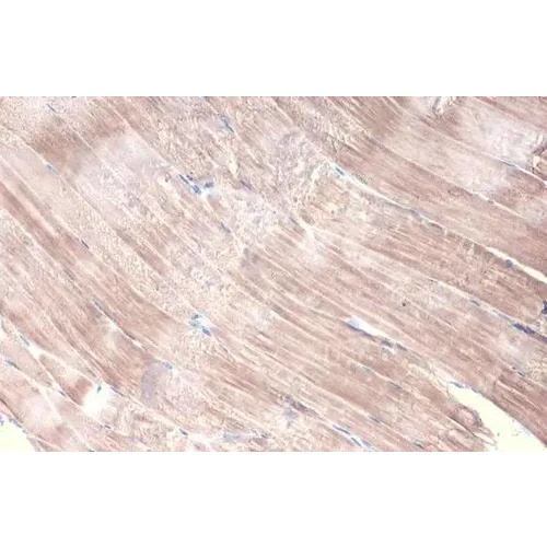 Anti-alpha Actinin antibody [HL1692] (ab317103) | Abcam