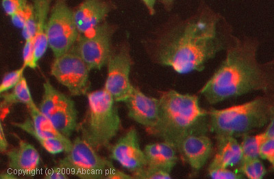 Anti-alpha Adducin antibody (ab51130) | Abcam