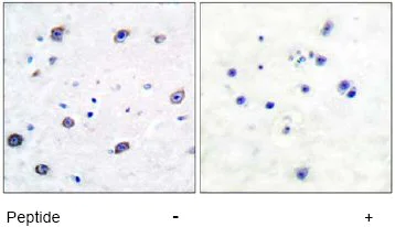 Anti-alpha Adducin antibody (ab51130) | Abcam