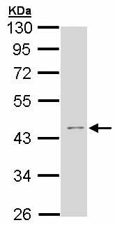 Anti-alpha Adducin antibody - N-terminal (ab151474) | Abcam