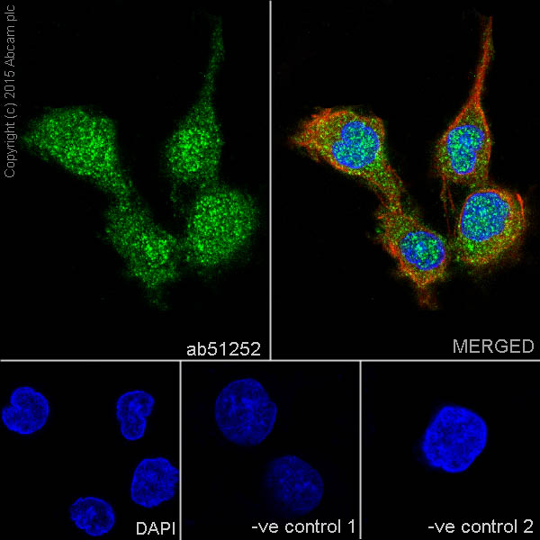 Anti-alpha + beta Synuclein antibody [EP1646Y] (ab51252) | Abcam