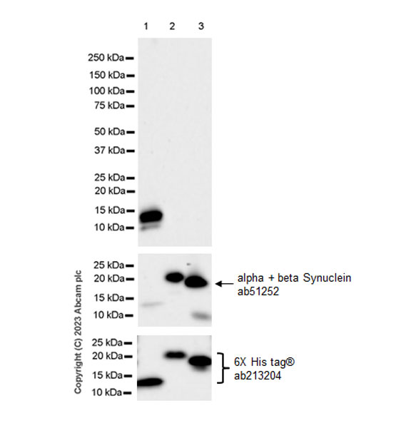 Anti-alpha + beta Synuclein antibody [EP1646Y] (ab51252) | Abcam