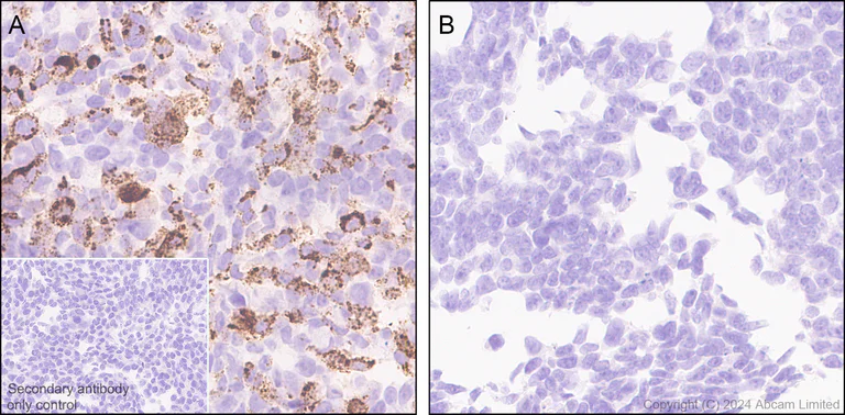 Anti-Alpha-S1-casein antibody [EPR29093-719] (ab323188) | Abcam