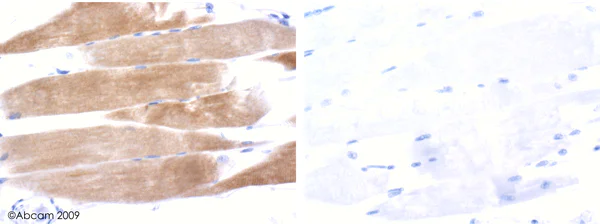 Anti-Alpha Skeletal Muscle Actin antibody - Loading Control (ab52218 ...