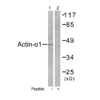 Anti-Alpha Skeletal Muscle Actin antibody - Loading Control (ab52218) | Abcam