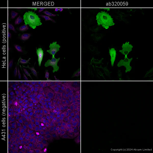 Anti-alpha smooth muscle Actin antibody [EPR5368] – Goat IgG (Chimeric) (ab320058) | Abcam