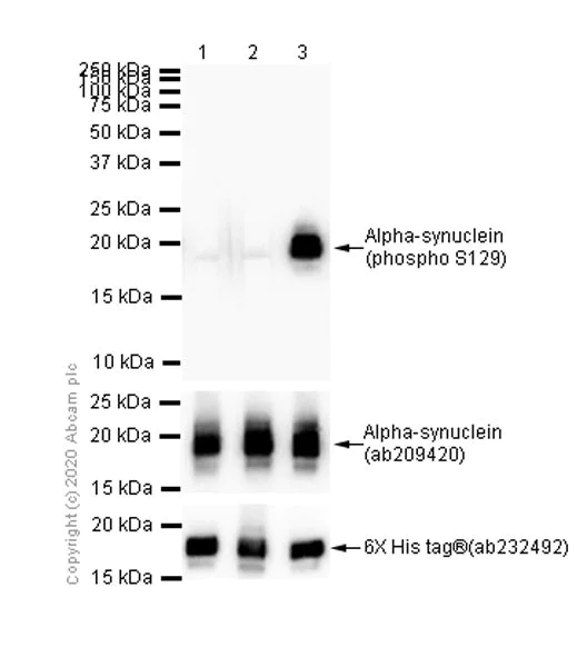 Alpha-synuclein(磷酸化S129)抗体[EP1536Y] (ab51253)| Abcam中文官网