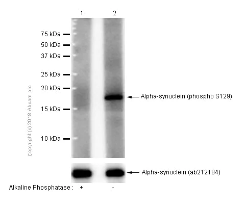 Anti-Alpha-synuclein (phospho S129) antibody [EP1536Y] (ab51253) | Abcam