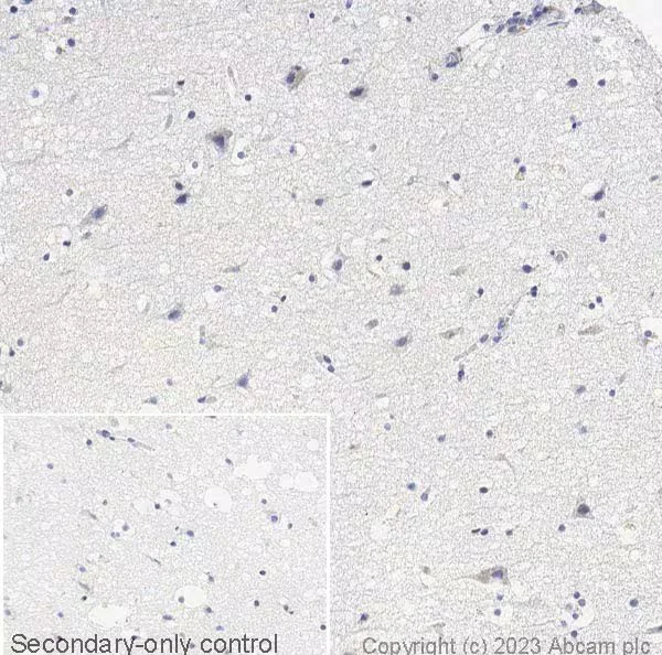 Anti-alpha-synuclein (phospho S129) antibody [P-syn/81A] (ab184674) | Abcam
