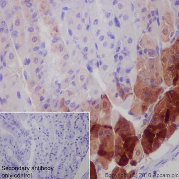 AMCase抗体[EPR19985] (ab207168)| Abcam中文官网